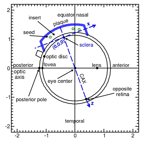 CLRP Eye Plaque Database v2 (CLRP_EPv2) | Department of Physics